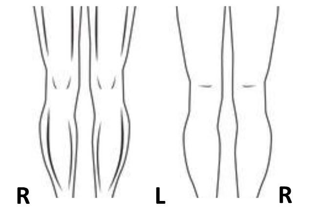MRI Safety/Knee Questionnaire